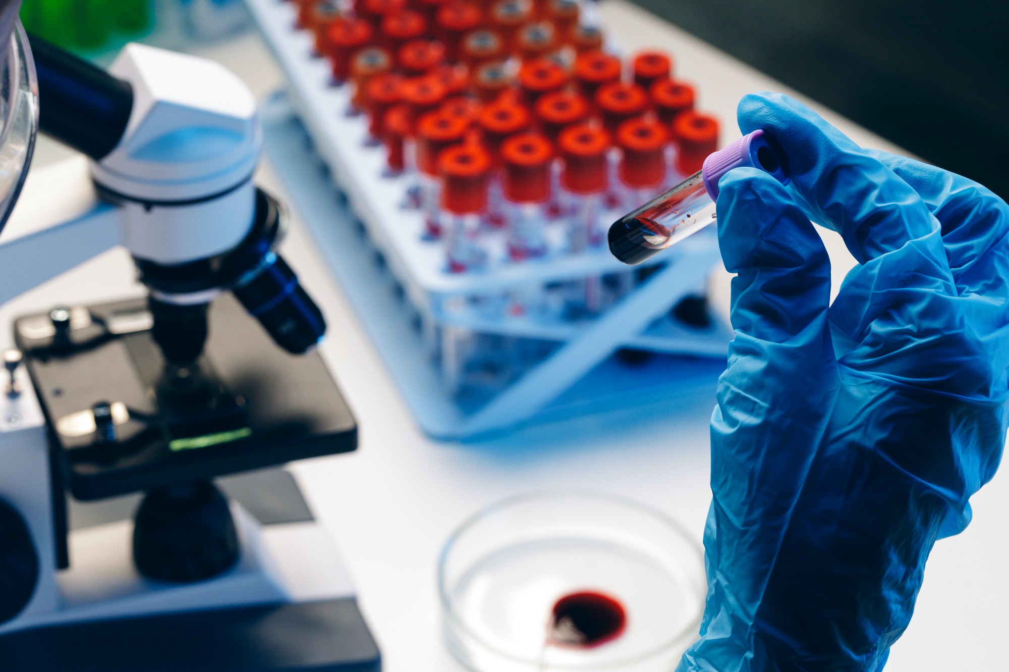 ΕΛΕΓΧΟΣ ΣΕΞΟΥΑΛΙΚΩΣ ΜΕΤΑΔΙΔΟΜΕΝΩΝ - Μικροβιολογικό Κομοτηνή